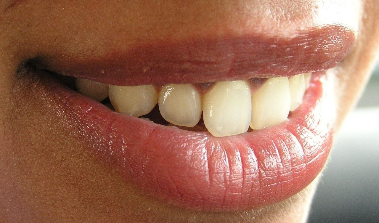 Lumineers | Estheticon.fr