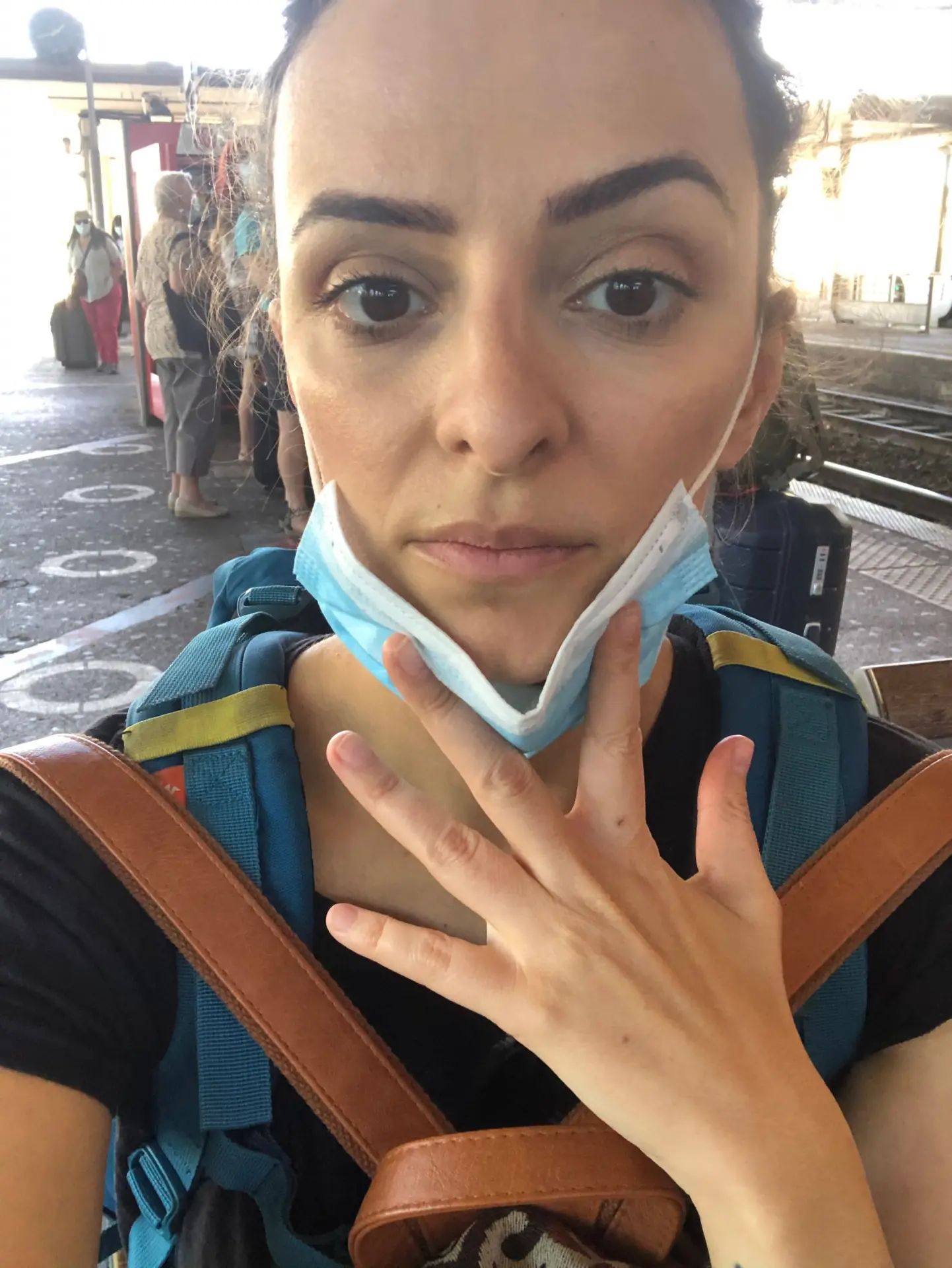 Nez dévié et pointe tombante après rhinoplastie | Estheticon.fr